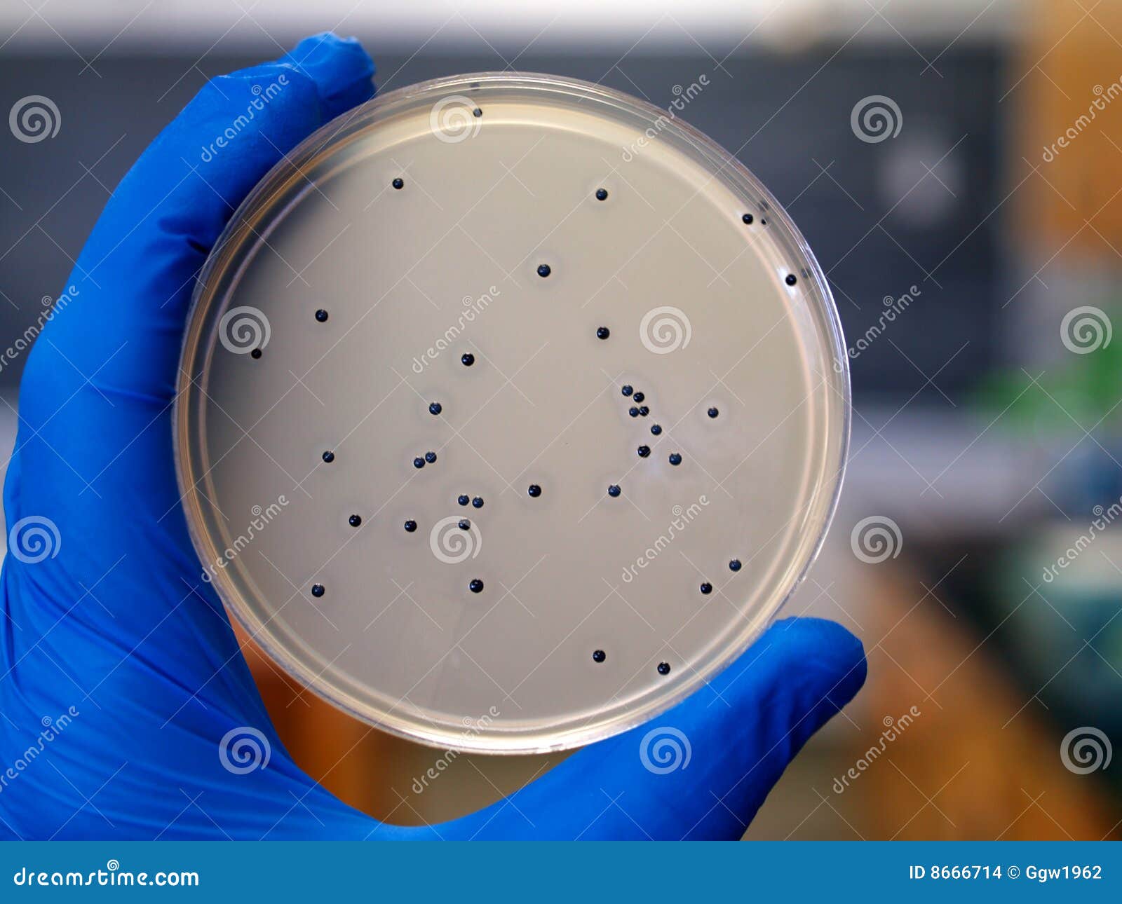 Bacterial Colonies stock photo. Image of hygiene, disease - 8666714