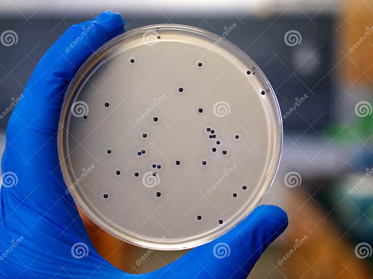 Bacterial Colonies stock photo. Image of hygiene, disease - 8666714