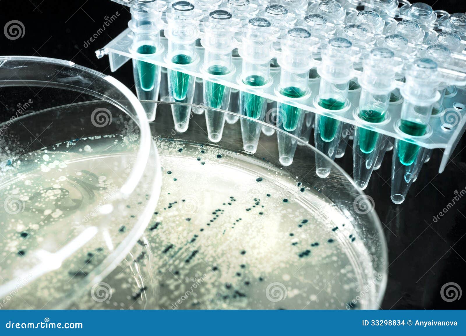 Bacterial Colonies on Agar Plate Stock Photo - Image of green ...
