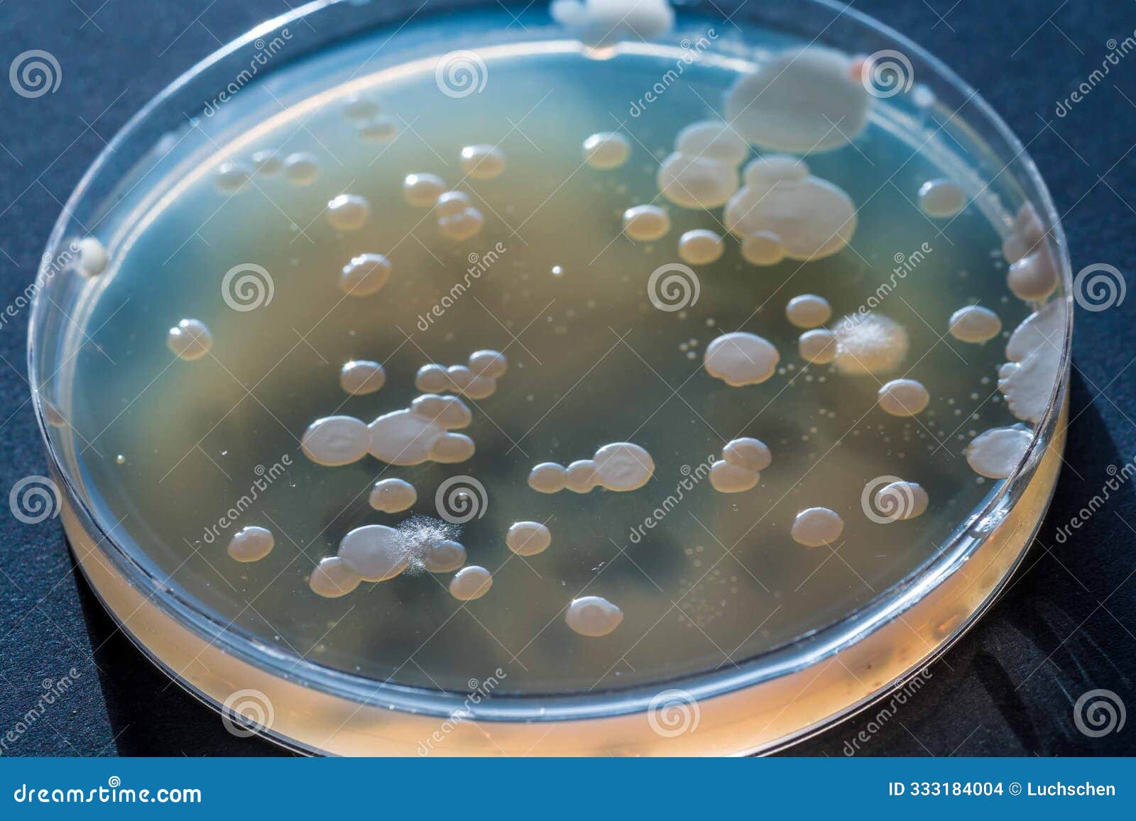 Bacterial Colonies on Agar Plate Stock Photo - Image of work ...