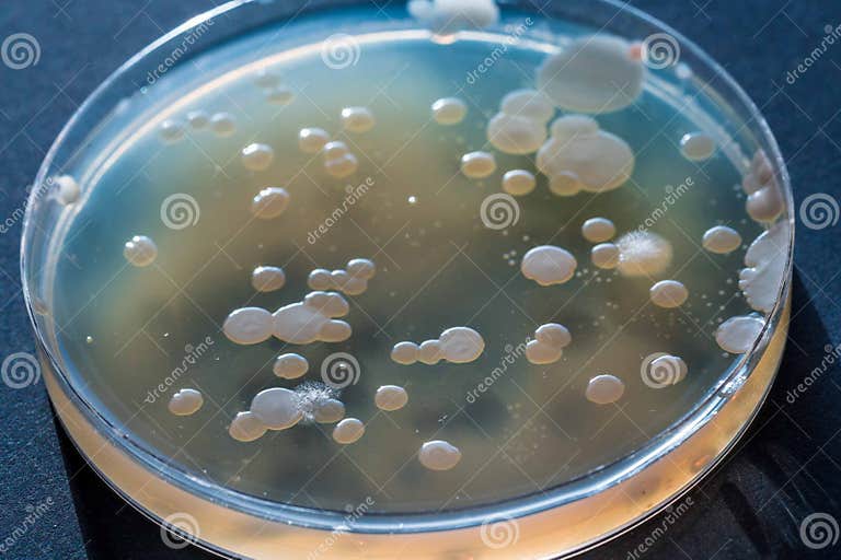 Bacterial Colonies on Agar Plate Stock Photo - Image of work ...