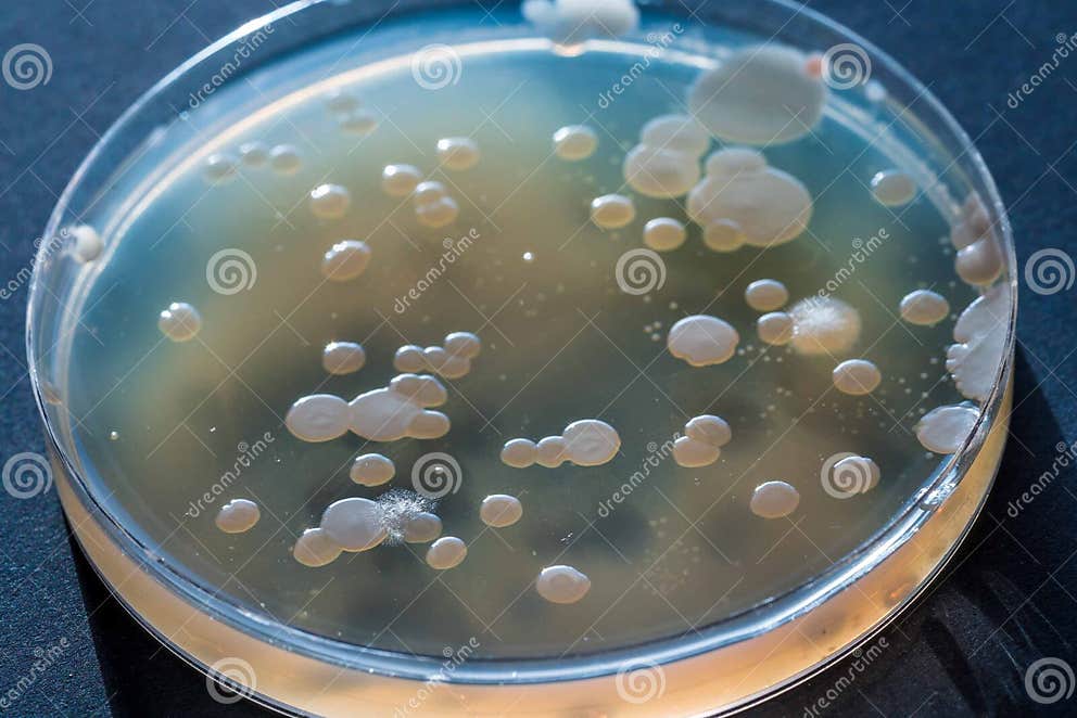 Bacterial Colonies on Agar Plate Stock Photo - Image of work ...