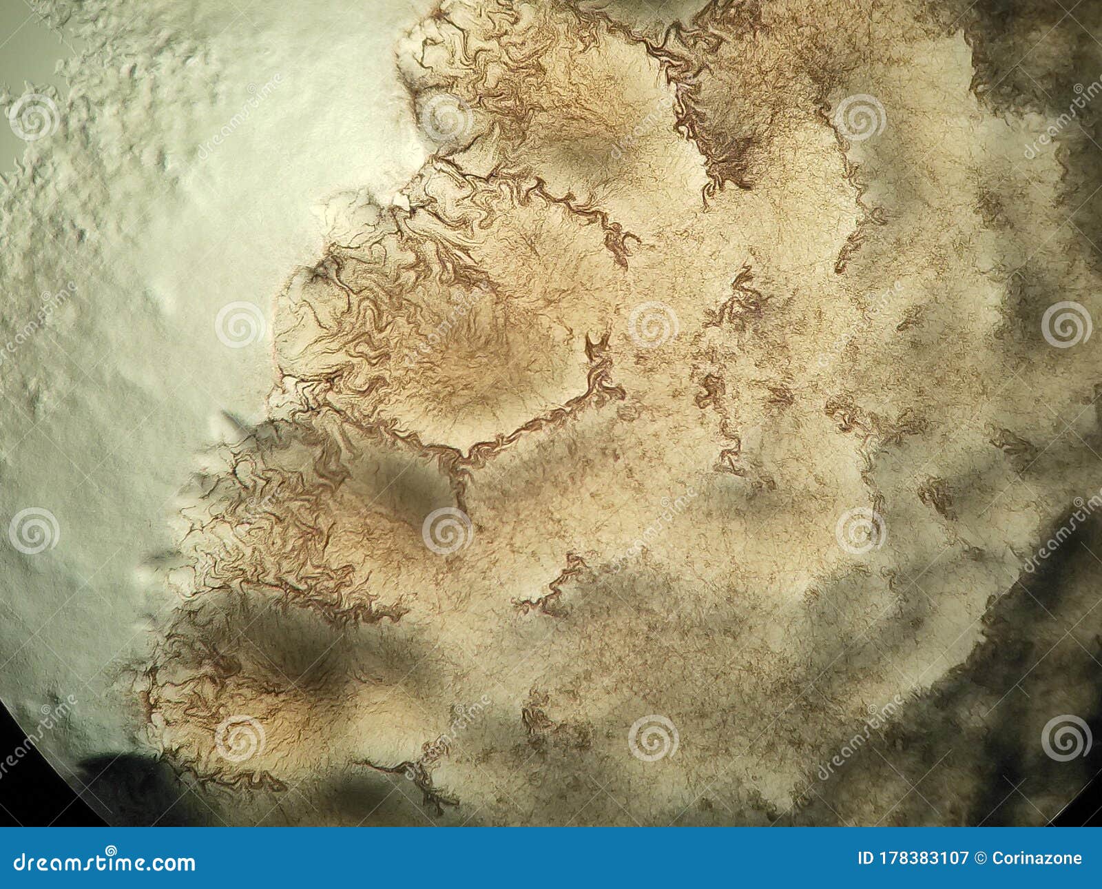 Microscope View of Bacillus and Other Bacteria Bacteria Growing in ...