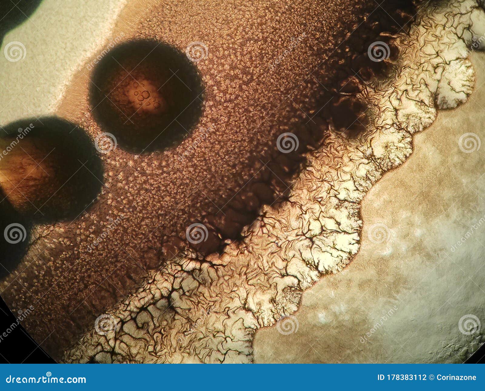 Microscope View of Bacillus and Other Bacteria Bacteria Growing in ...