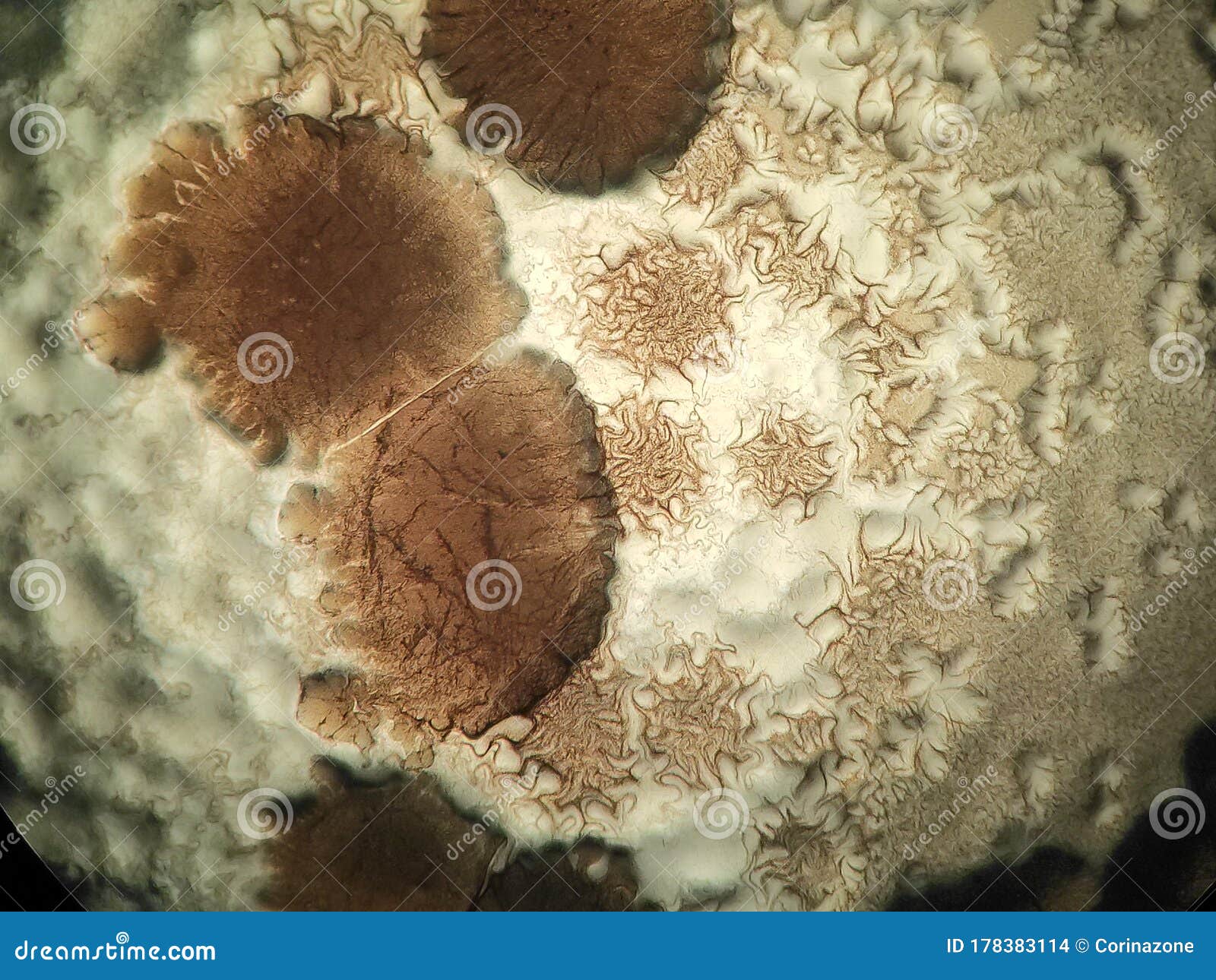 Microscope View of Bacillus and Other Bacteria Bacteria Growing in ...