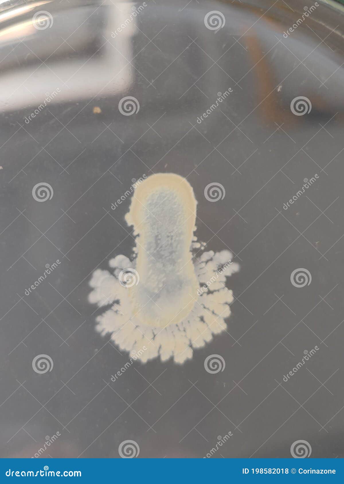 Bacterial Colony on Nutrient Agar Medium Stock Photo - Image of view ...
