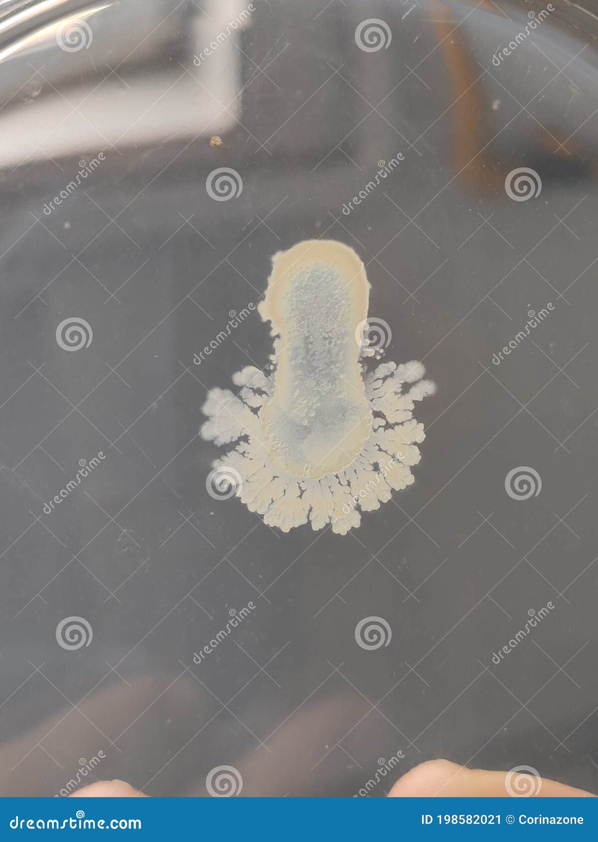 Bacterial Colony on Nutrient Agar Medium Stock Image - Image of growing ...