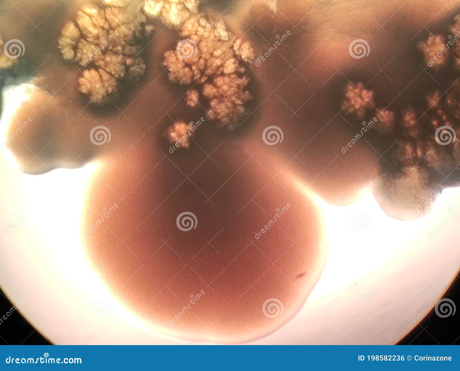 Microscope View of a Bacterial Colony Stock Photo - Image of bacteeria ...