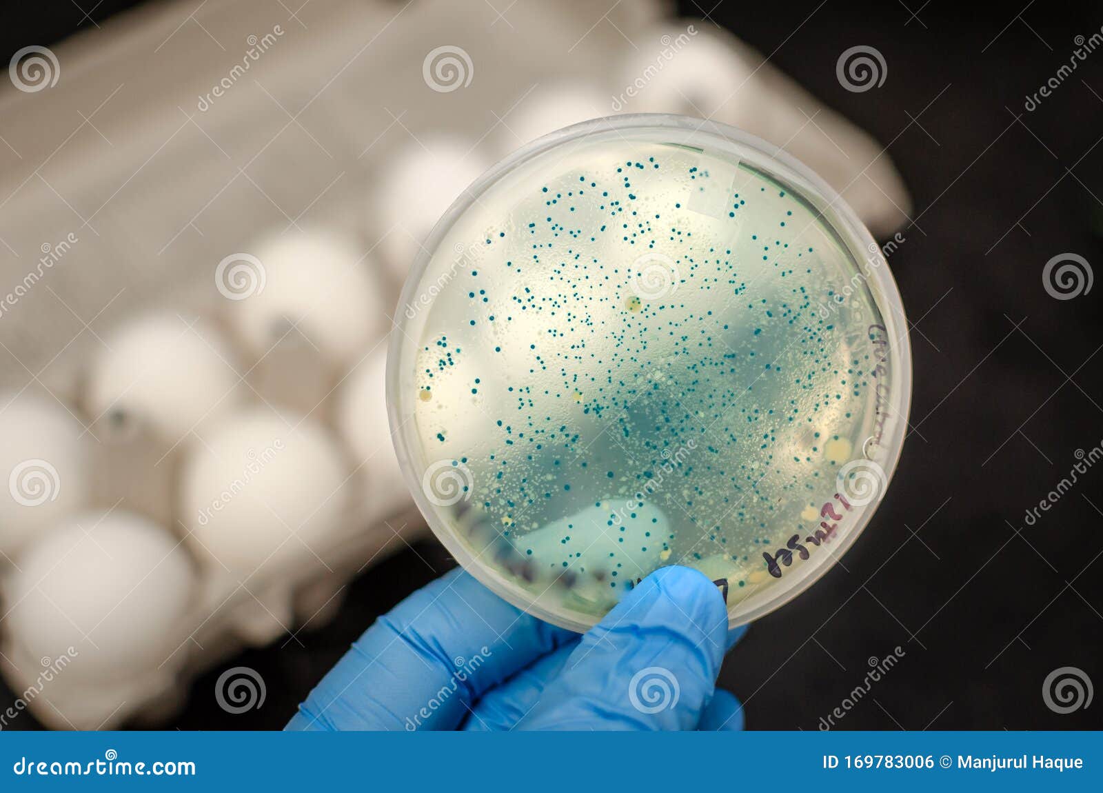 Bacterial Contamination On Agar Media Royalty-Free Stock Photo ...