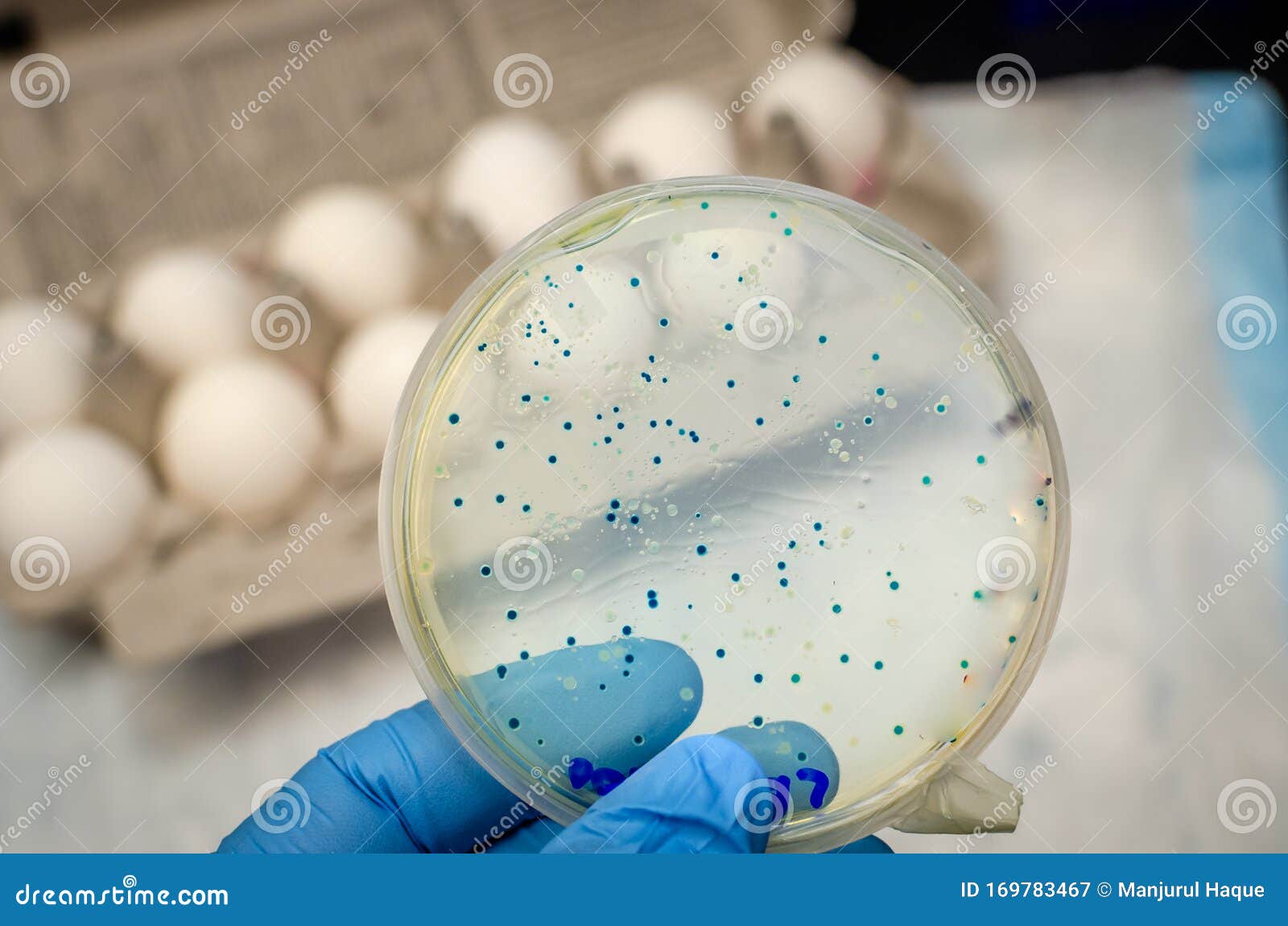 Bacterial Contamination in Egg Stock Image - Image of microorganisms ...
