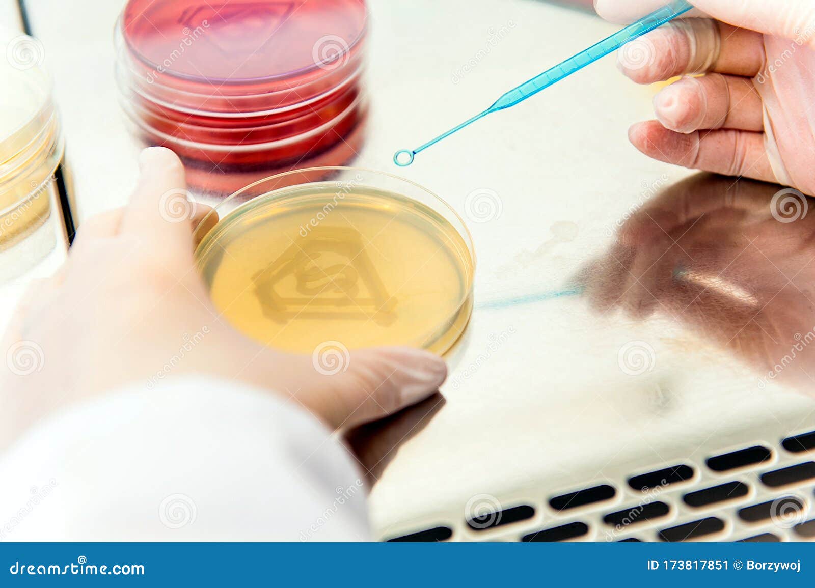 Bacterial Culture Growth On Blood Agar (Gram Positive Cocci). Royalty ...