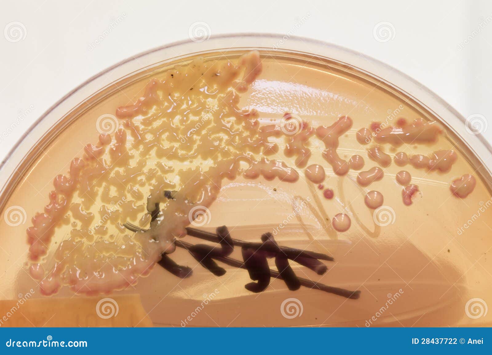 Bacterial Cultures On Agar Stock Photography | CartoonDealer.com #28437722