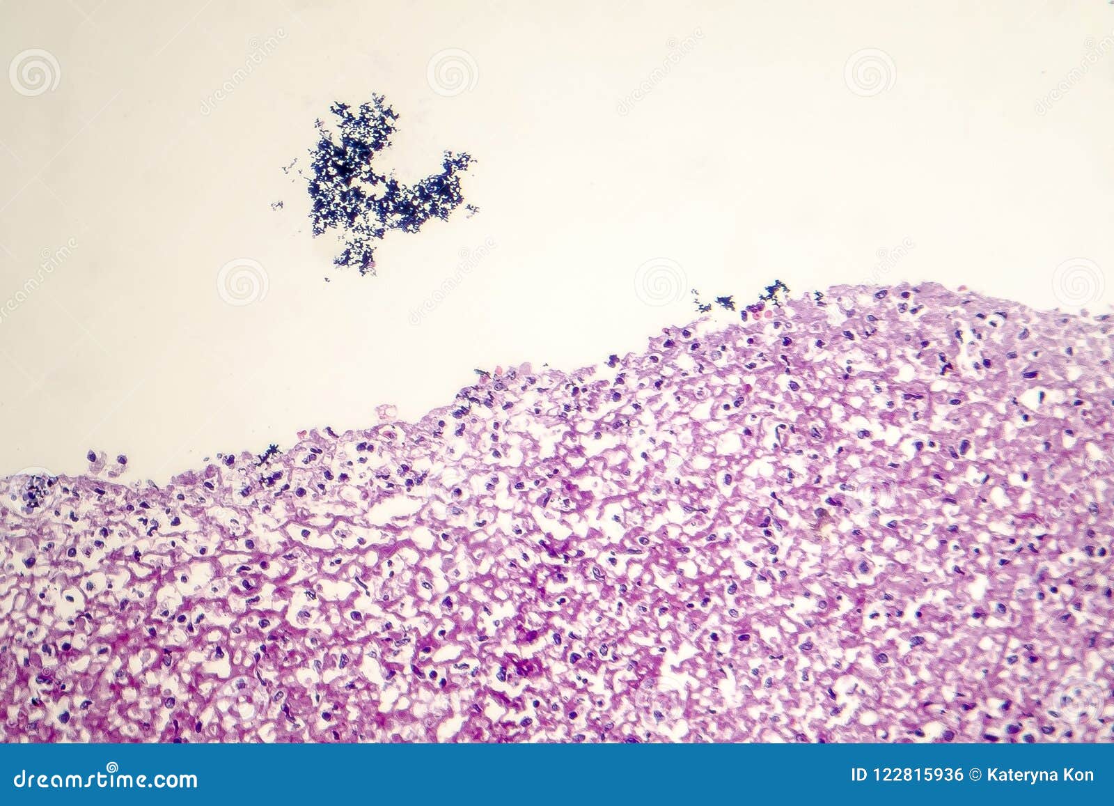 Bacterial Dysentery, Light Micrograph Stock Photo - Image of eosin ...