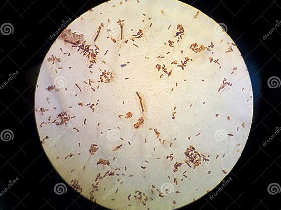 Bacterial flagellum e.coli stock photo. Image of colony - 24741612