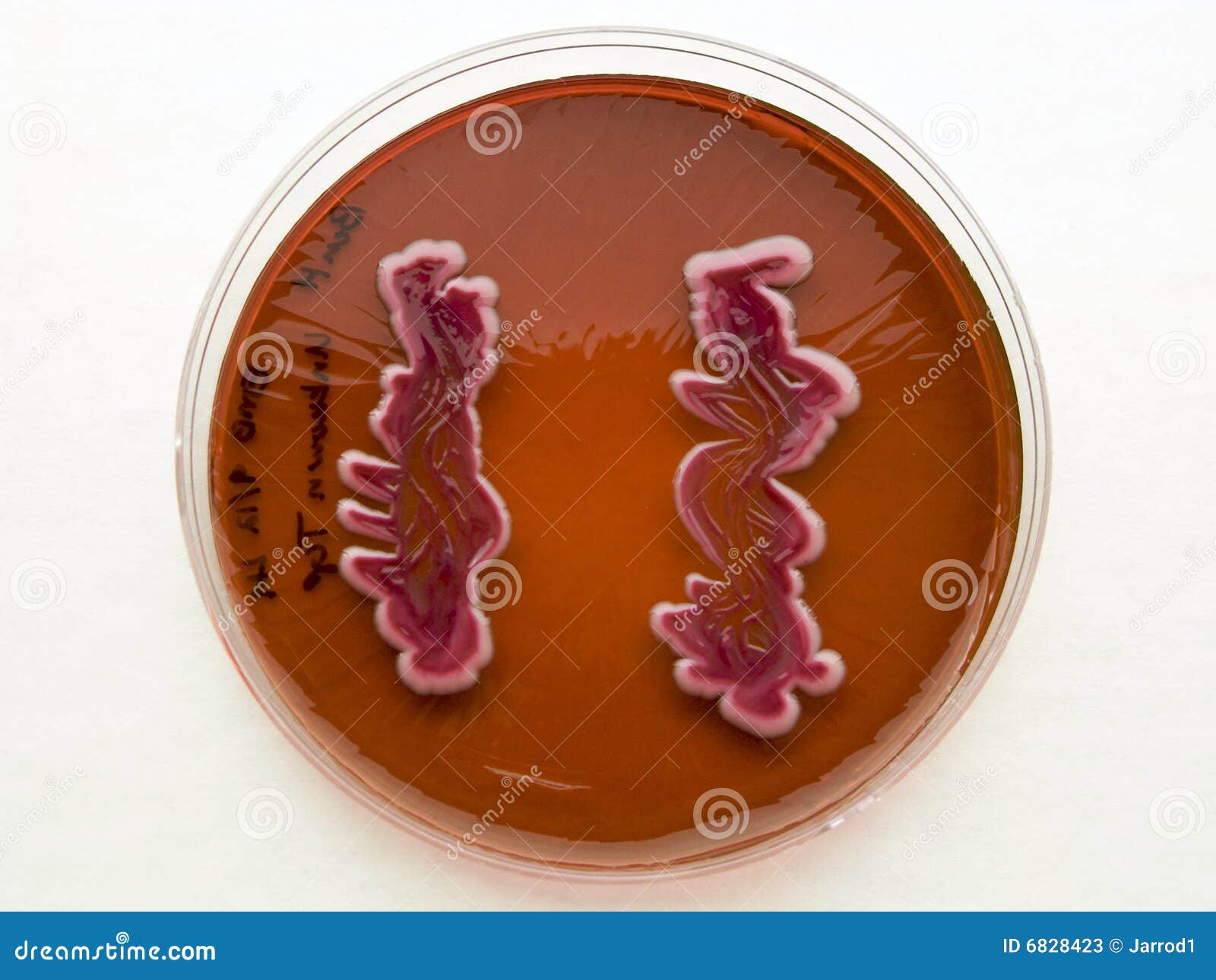 Bacterial Growth on Differential Agar Stock Image - Image of biological ...