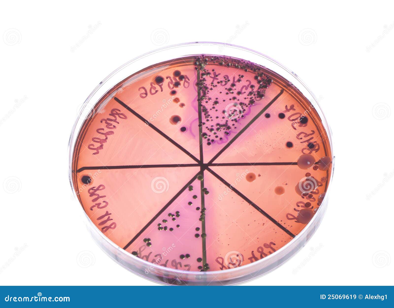 Bacterias En El Plato De Petri Imagen de archivo - Imagen de ciencia ...