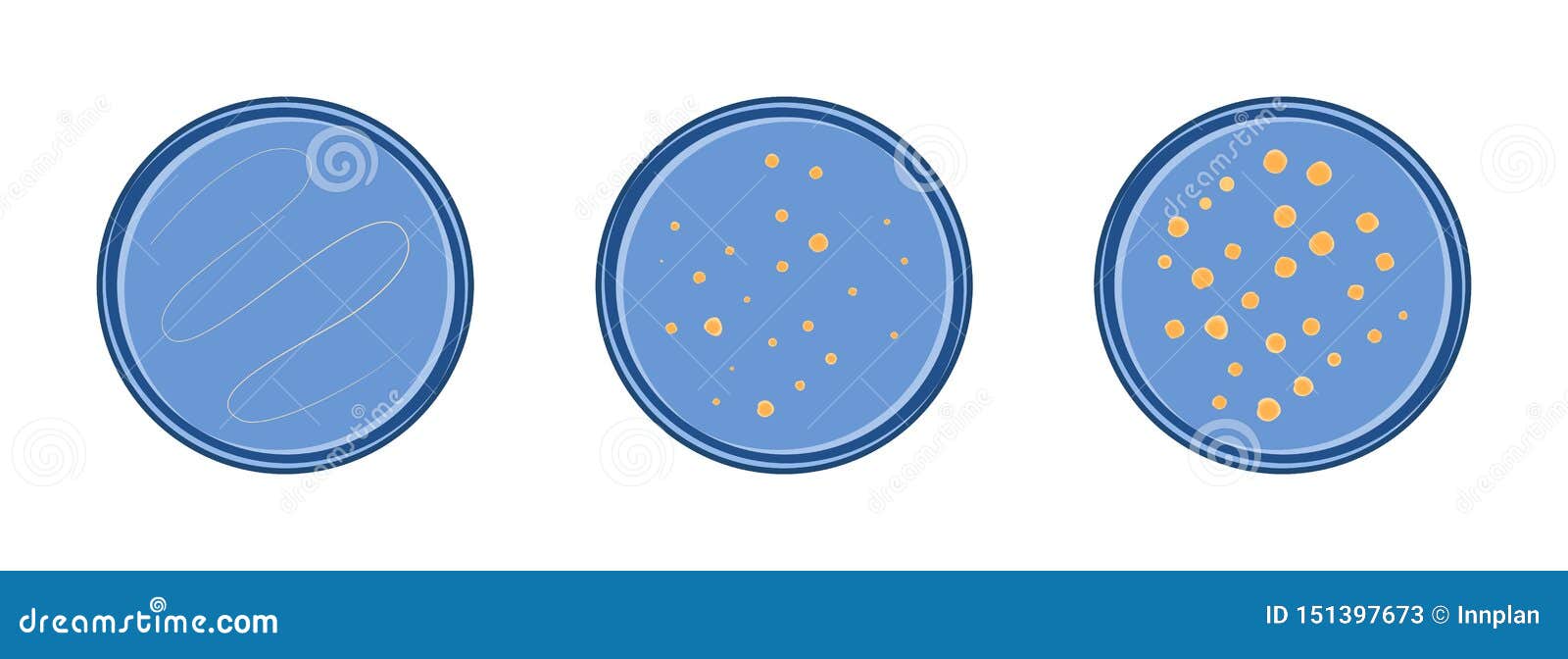 Bacterium Growth In Different Colonies, Vector. | CartoonDealer.com ...