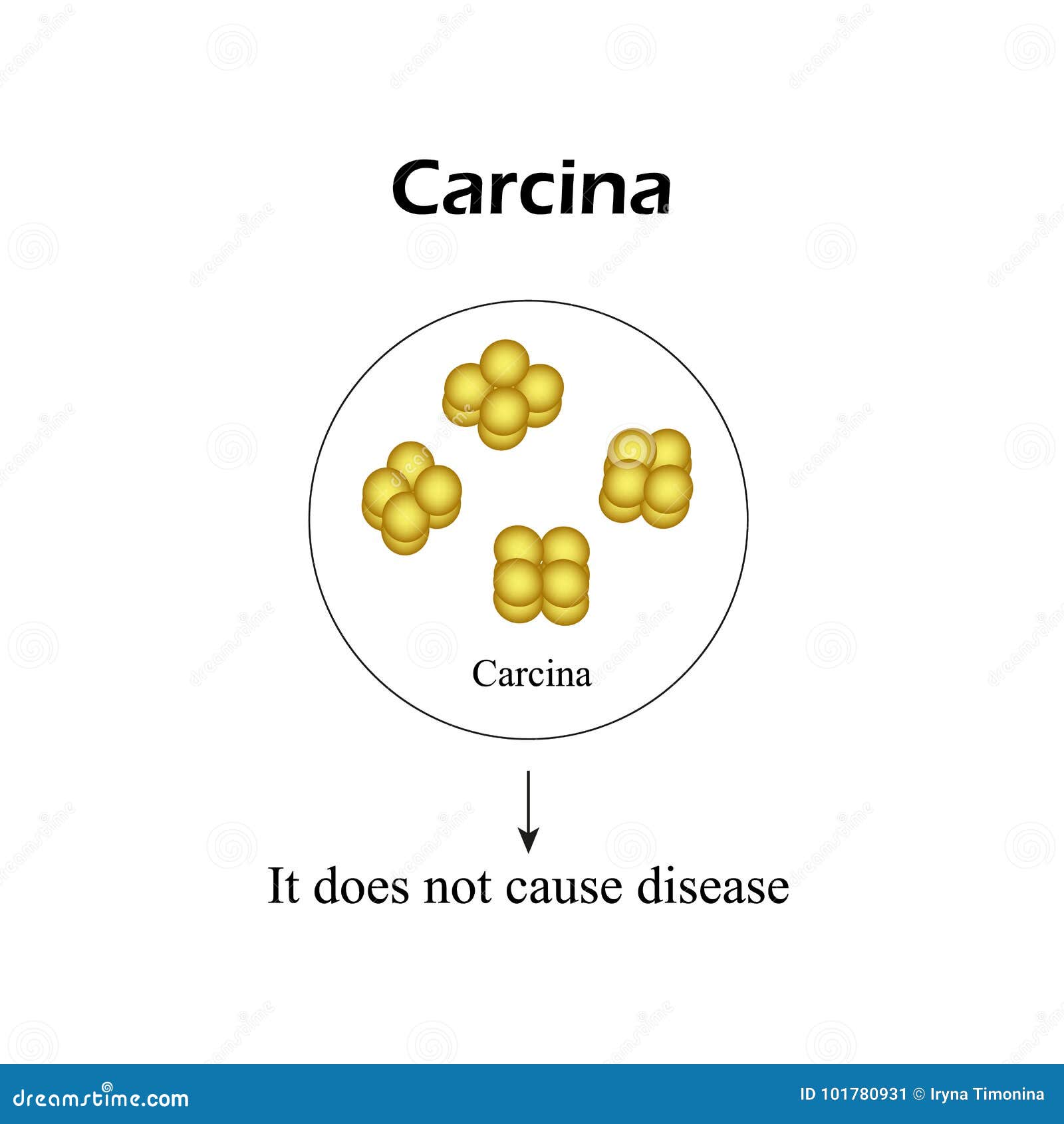 The Bacterium Sarcina. Infographics Stock Vector - Illustration of ...