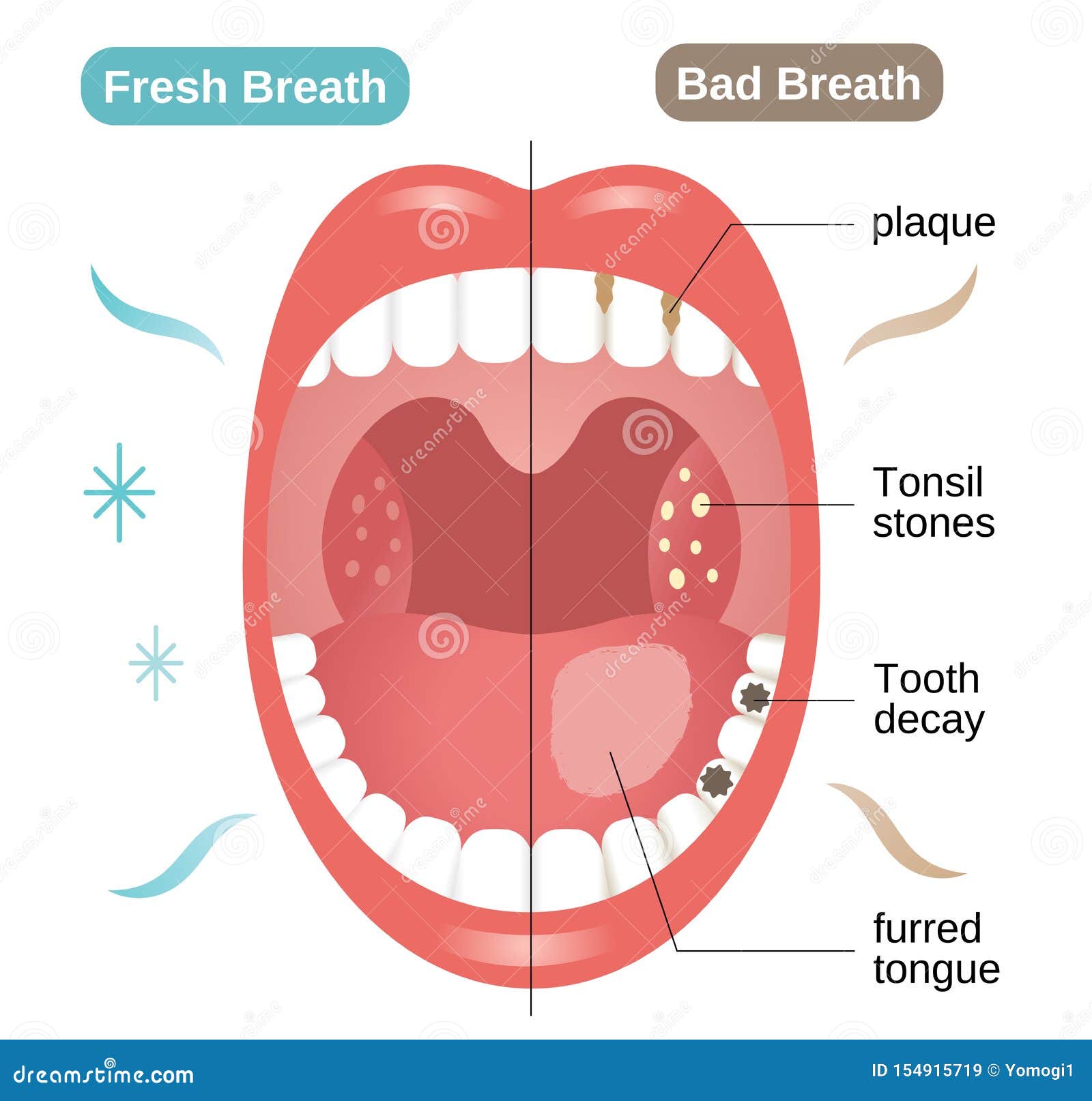 Bacteria Produce Halitosis for Dental Hygiene and Personal Care Use ... Bacteria Produce Halitosis for Dental Hygiene and Personal Care Use ...