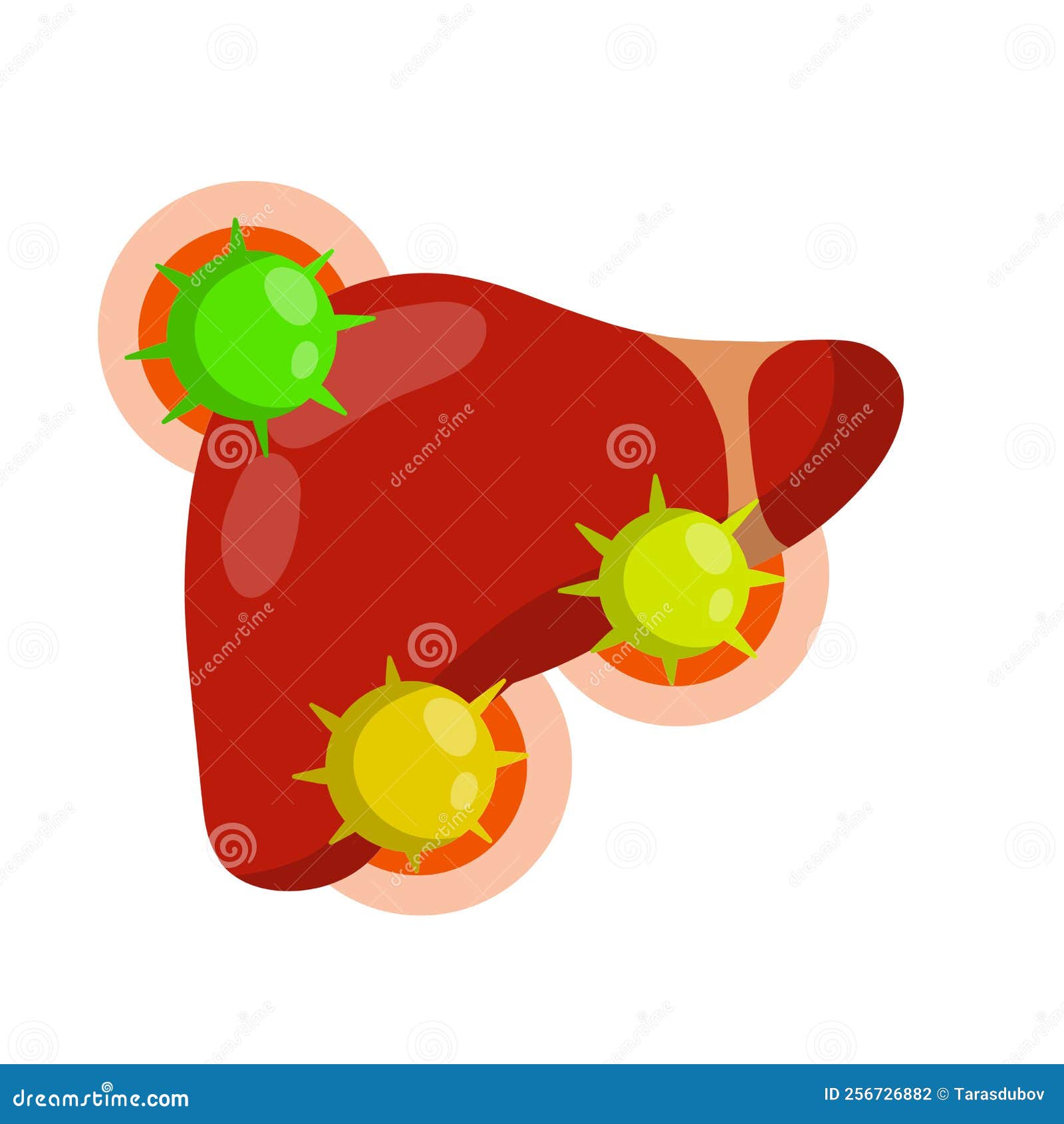Bad Liver. Attack Germs and Cirrhosis of the Liver Stock Vector ...