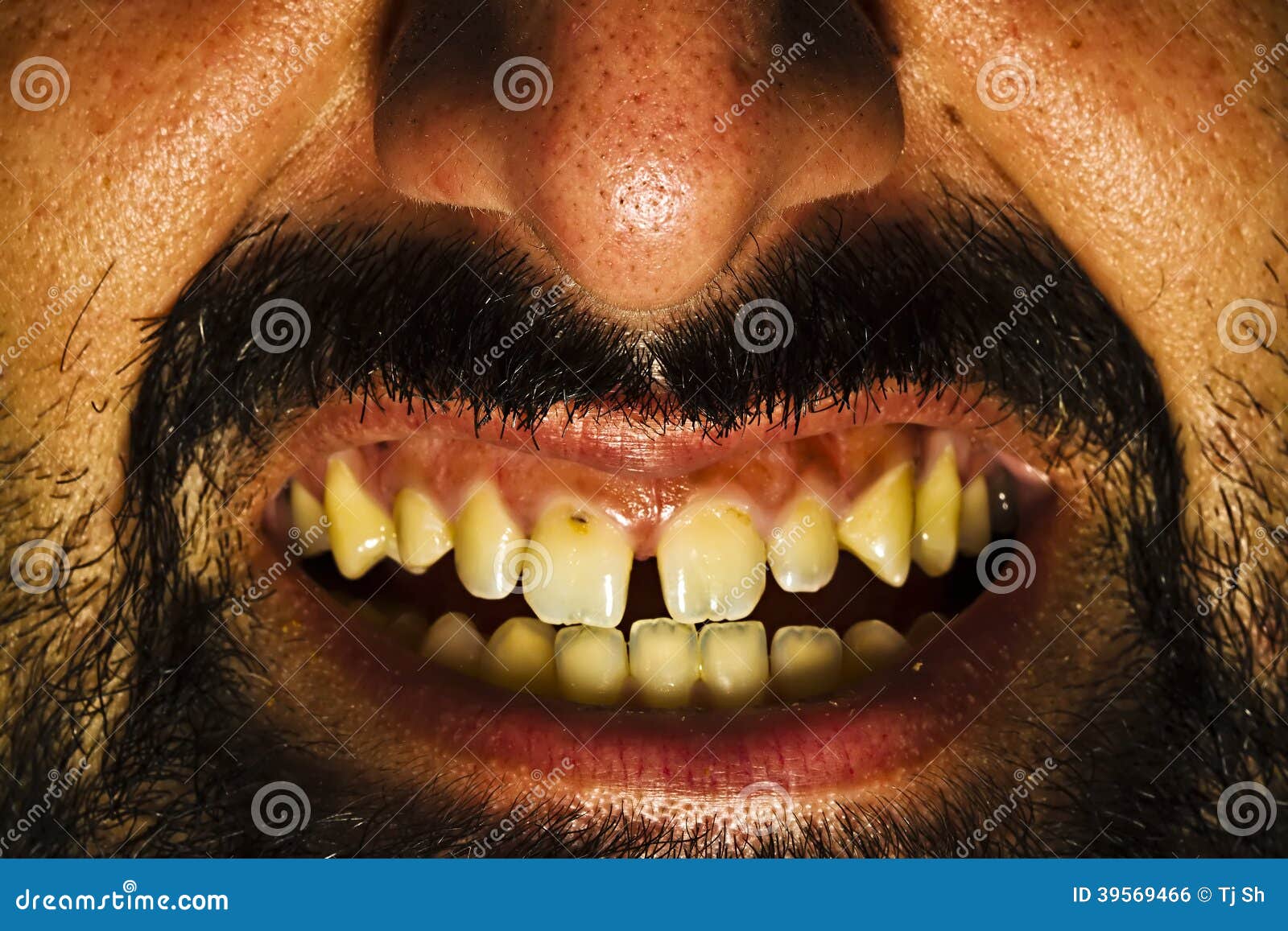 Bad Teeth Stock Photo | CartoonDealer.com #39569466