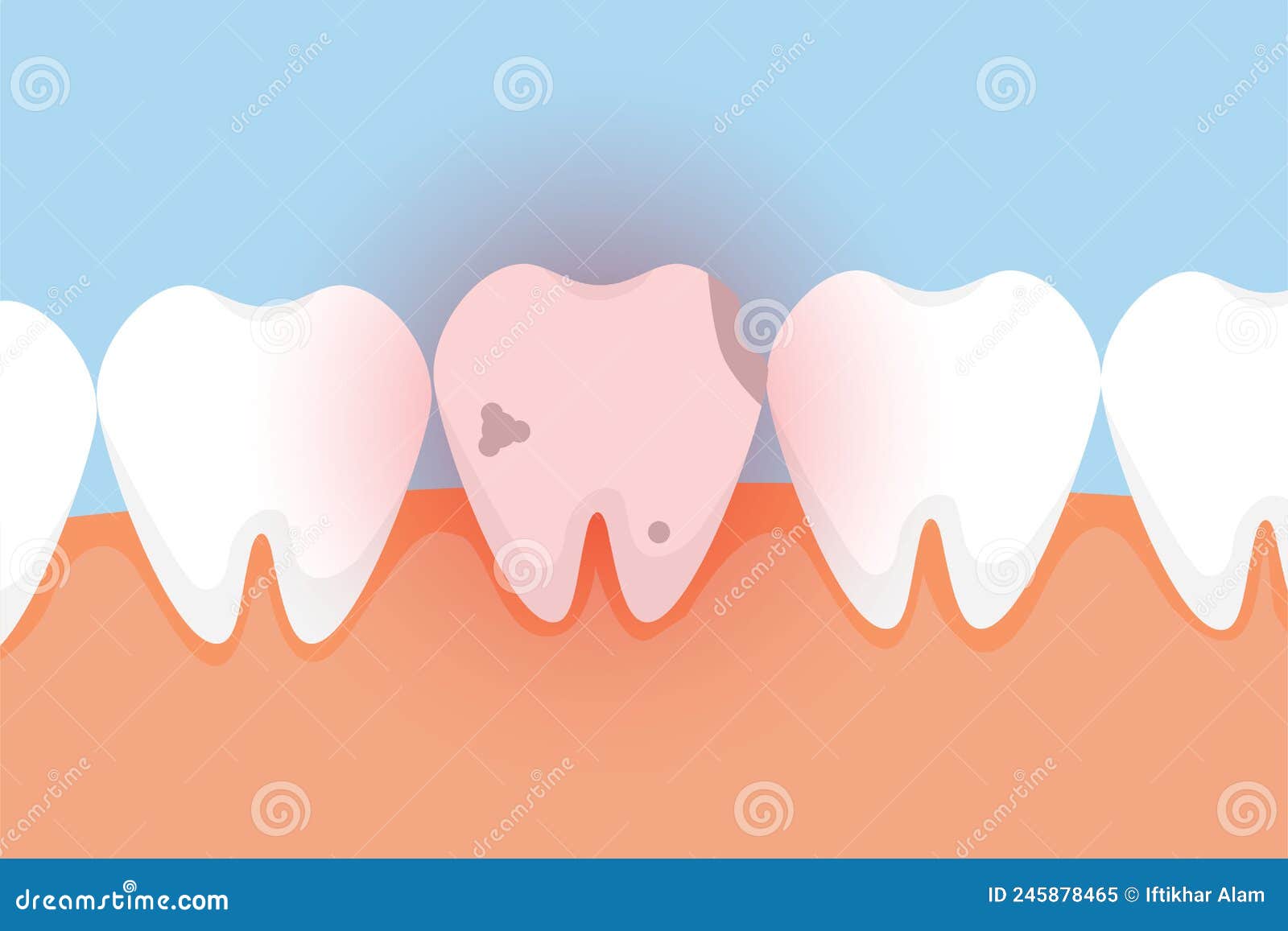 Bad Tooth Hurting With Red Danger Glow Effect Vector. A Dead Tooth ...