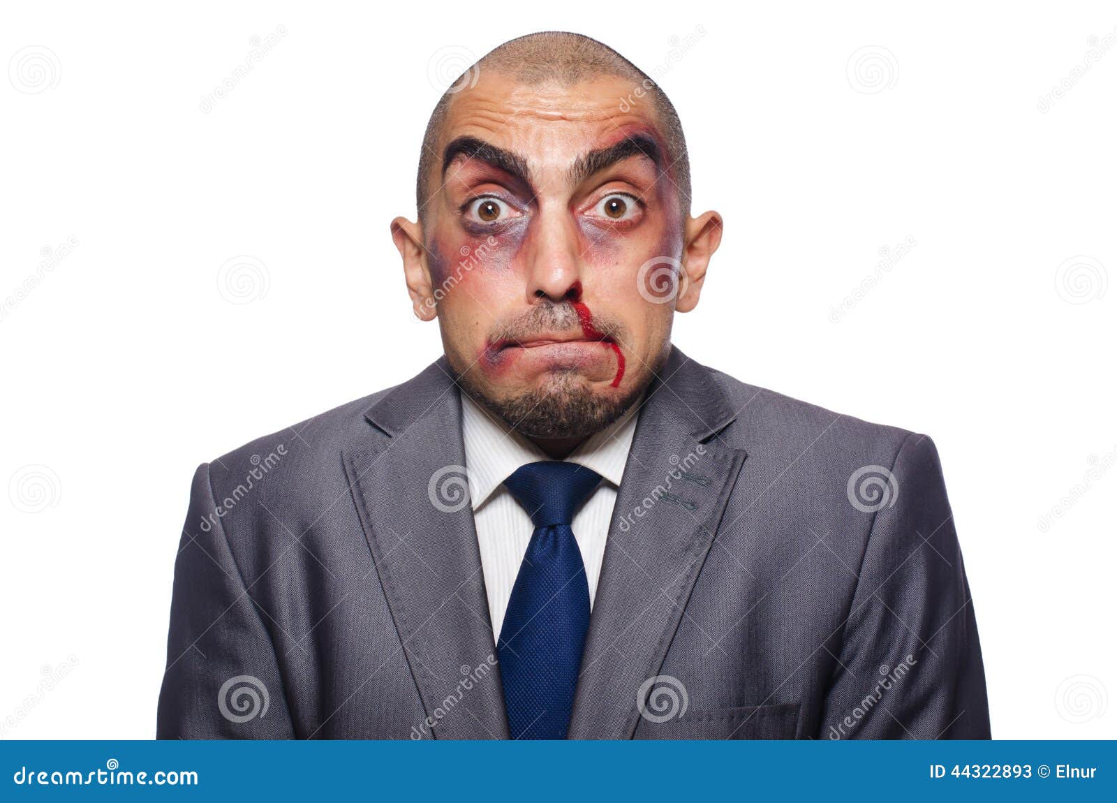 Badly Beaten Businessman Isolated Stock Image - Image of hematoma ...