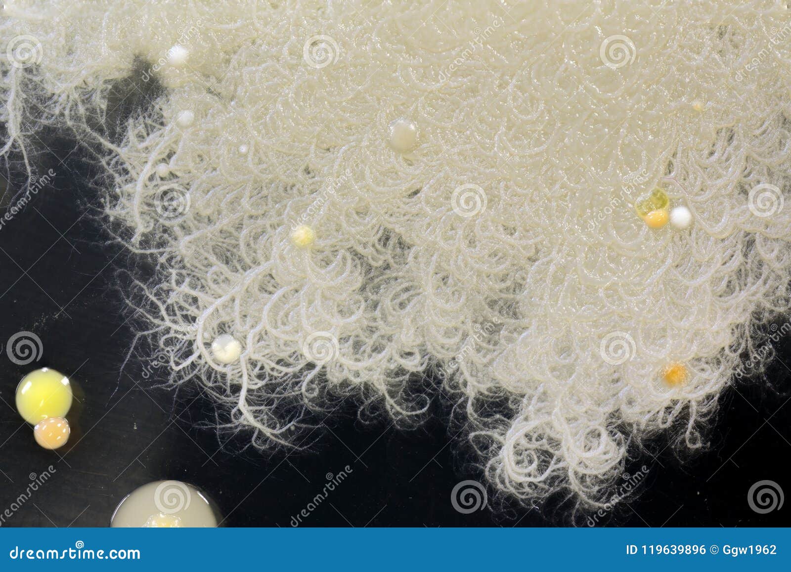 Bakterien, Hefe Und Form Auf Einer Petri-Platte Stockfoto - Bild von ...