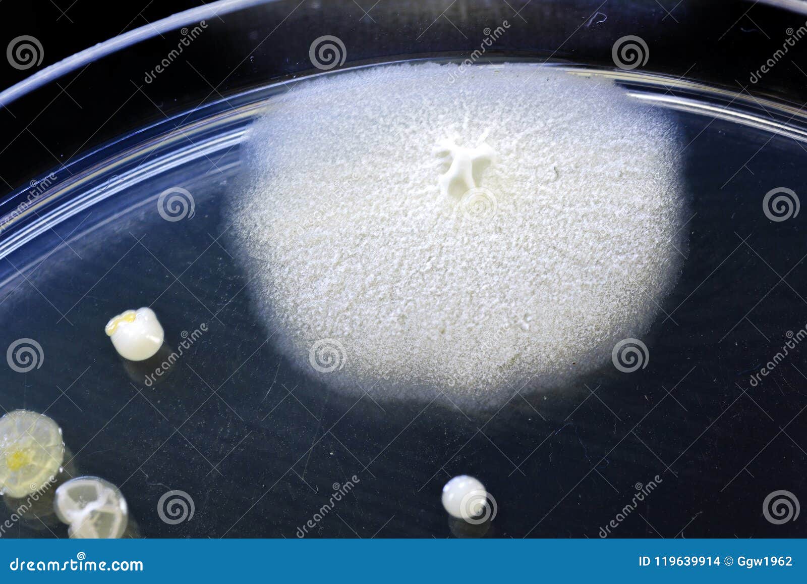 Bakterien, Hefe Und Form Auf Einer Petri-Platte Stockfoto - Bild von ...