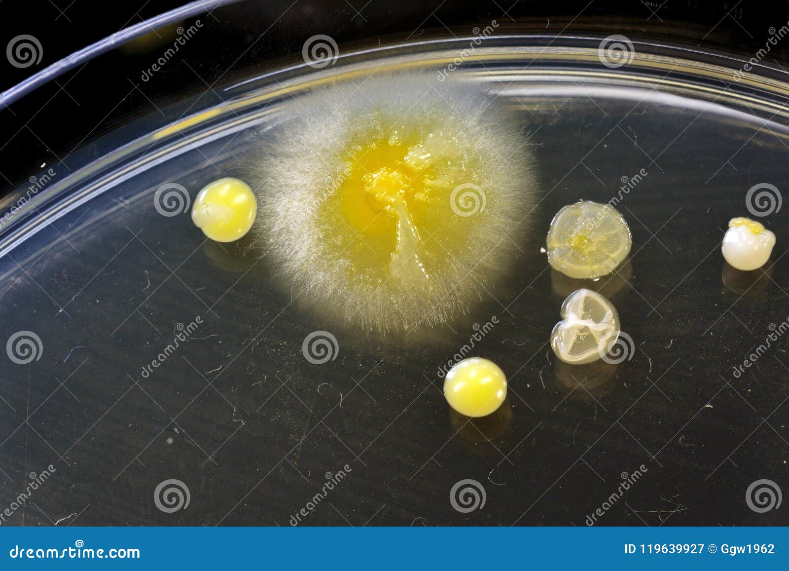 Bakterien, Hefe Und Form Auf Einer Petri-Platte Stockbild - Bild von ...