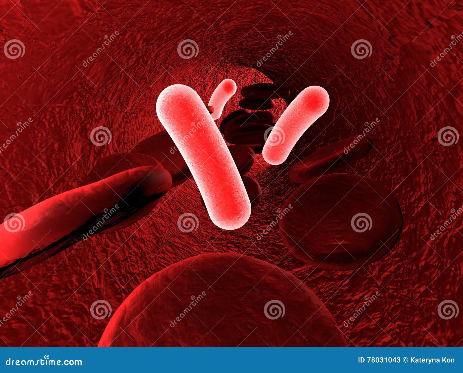 Bakterien Im Blut, Bacteriemia Stock Abbildung - Illustration von ...