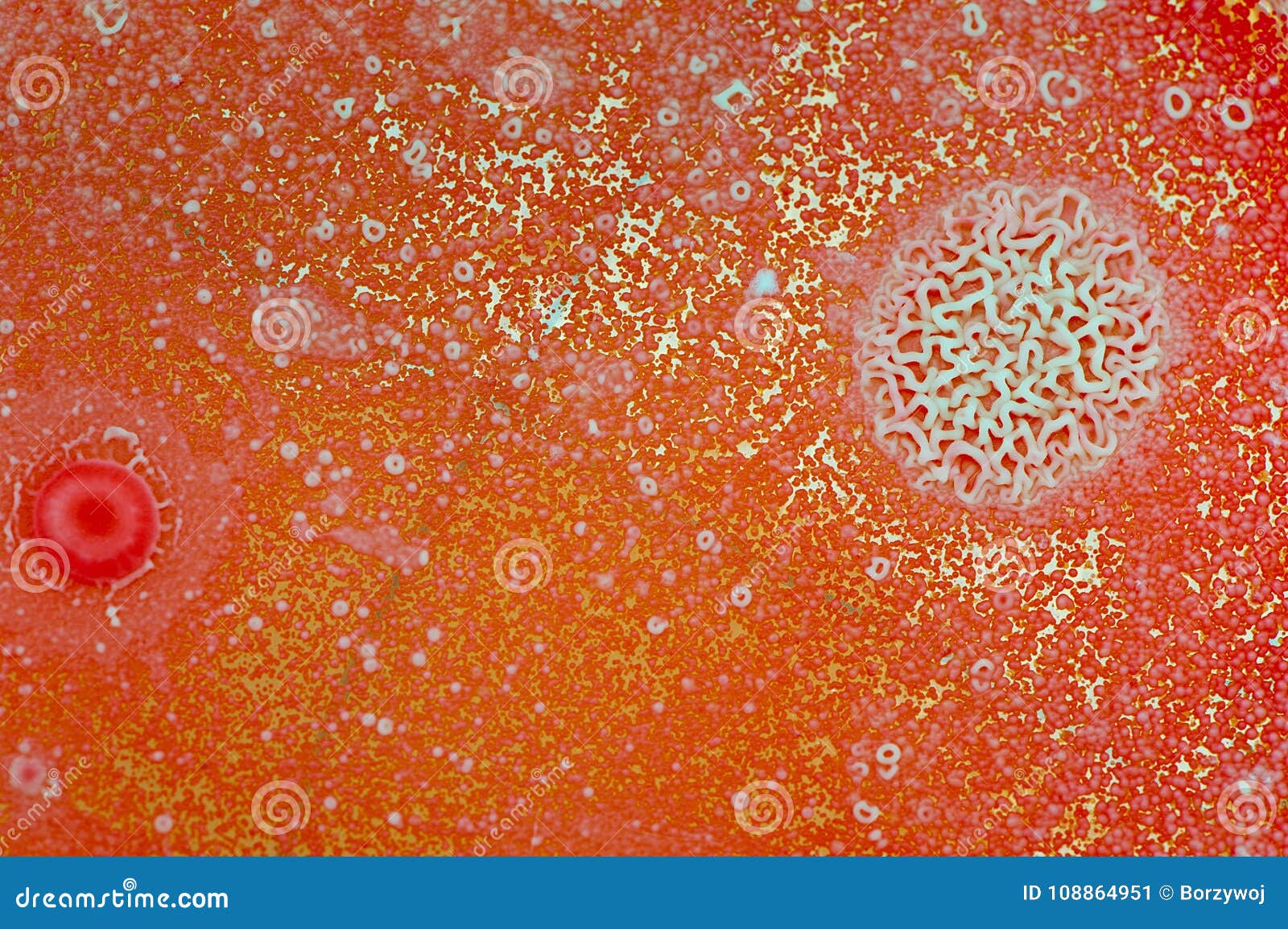 Bakterien Und Hefe in Petrischale Stockbild - Bild von bazillus ...