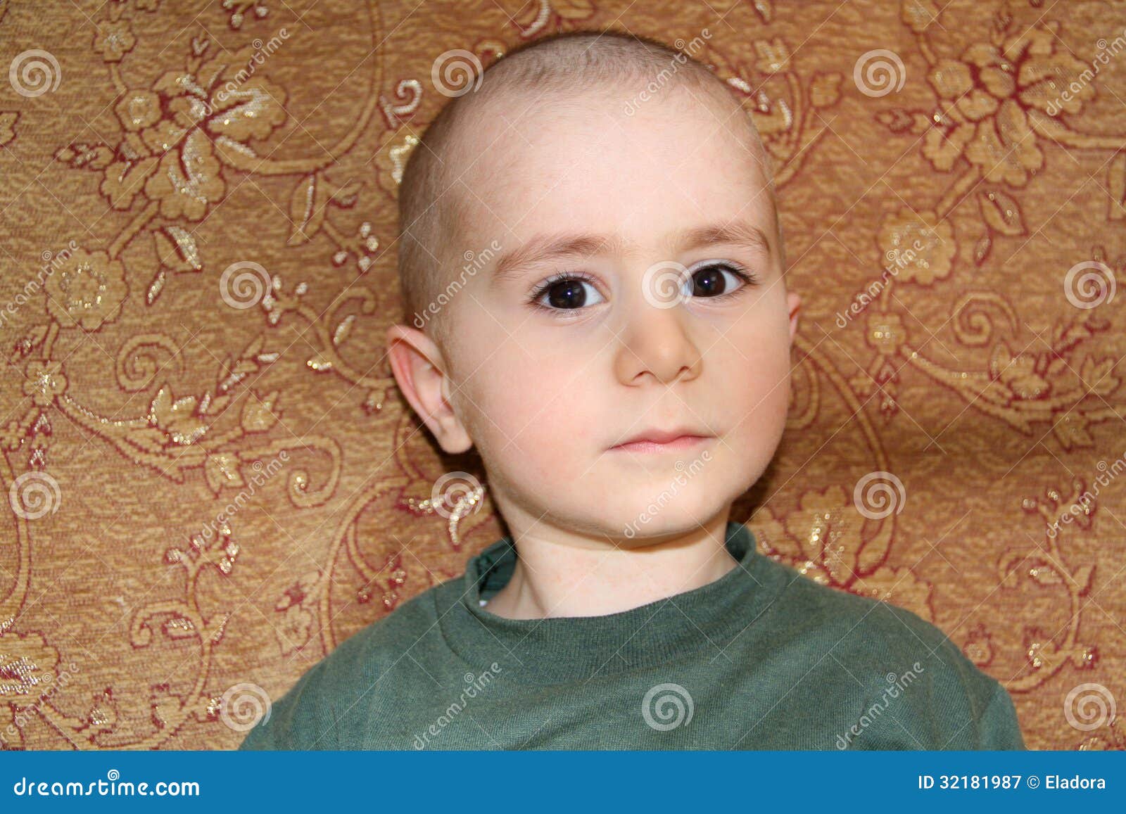Bald boy portrait stock image. Image of protective, chemotherapy - 32181987