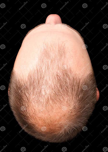 Bald head cut-out stock image. Image of background, closeups - 12363767