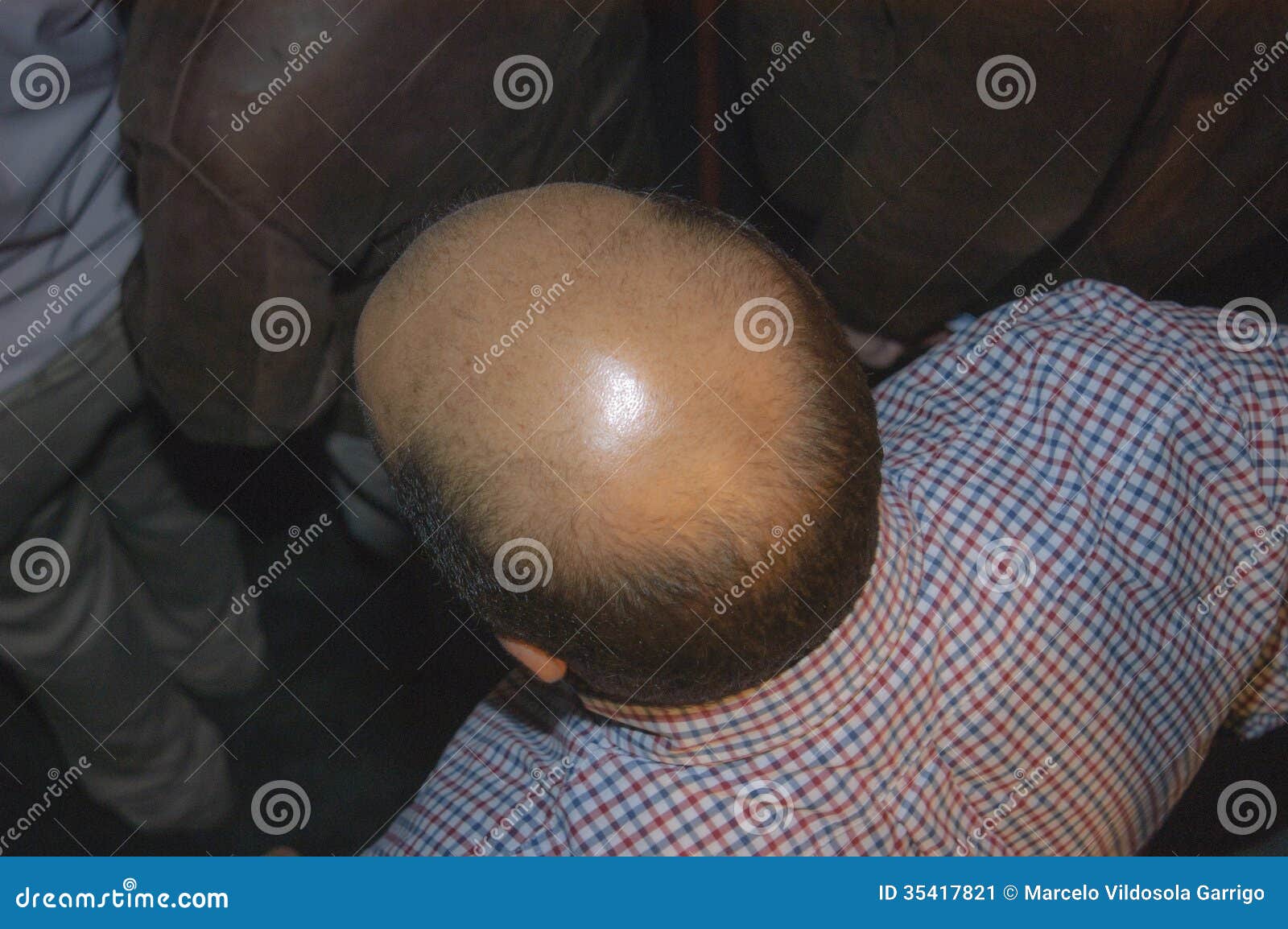 Bald head stock image. Image of balding, head, detail - 35417821