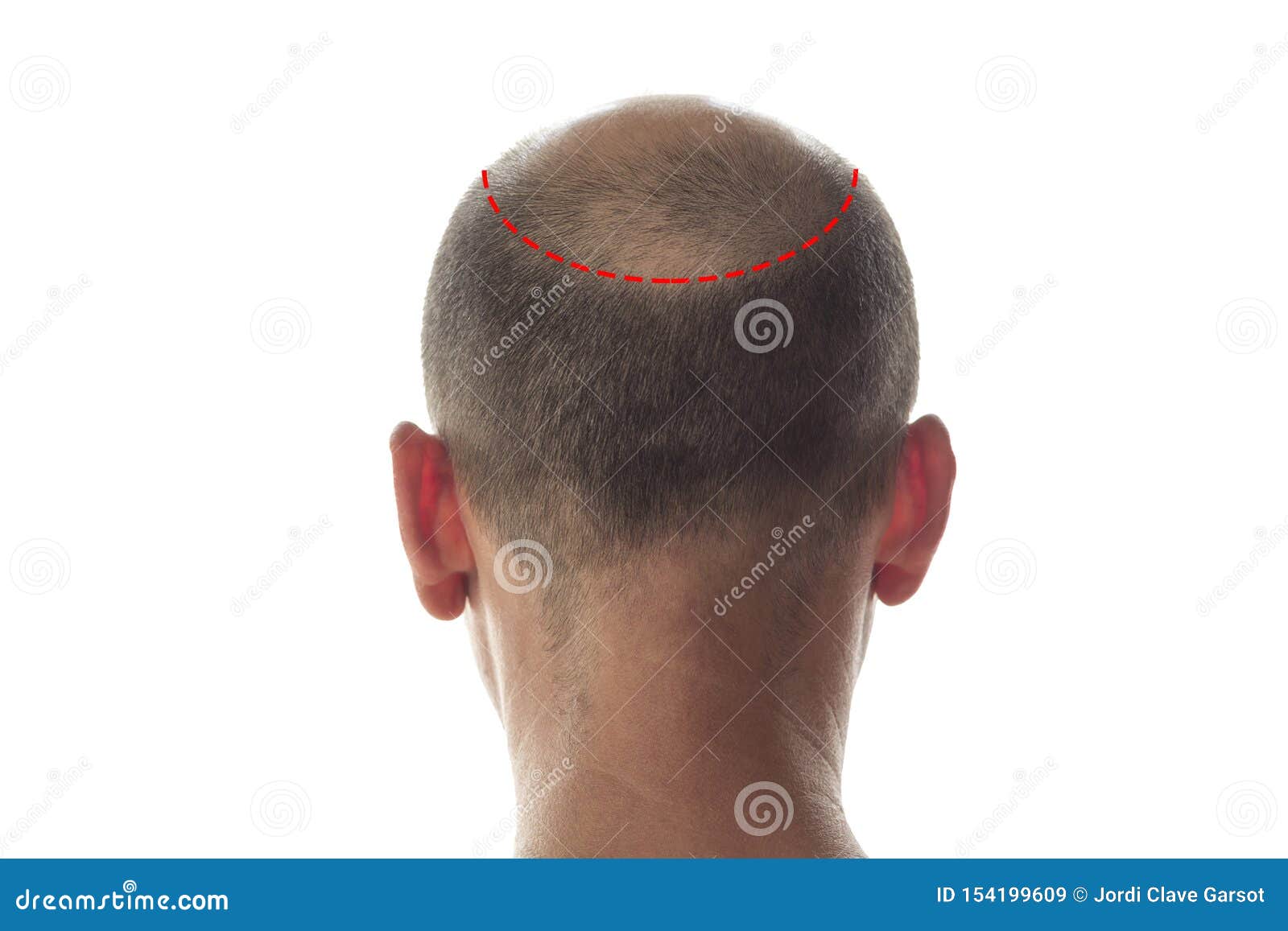 Bald man head on the back stock image. Image of balding - 154199609