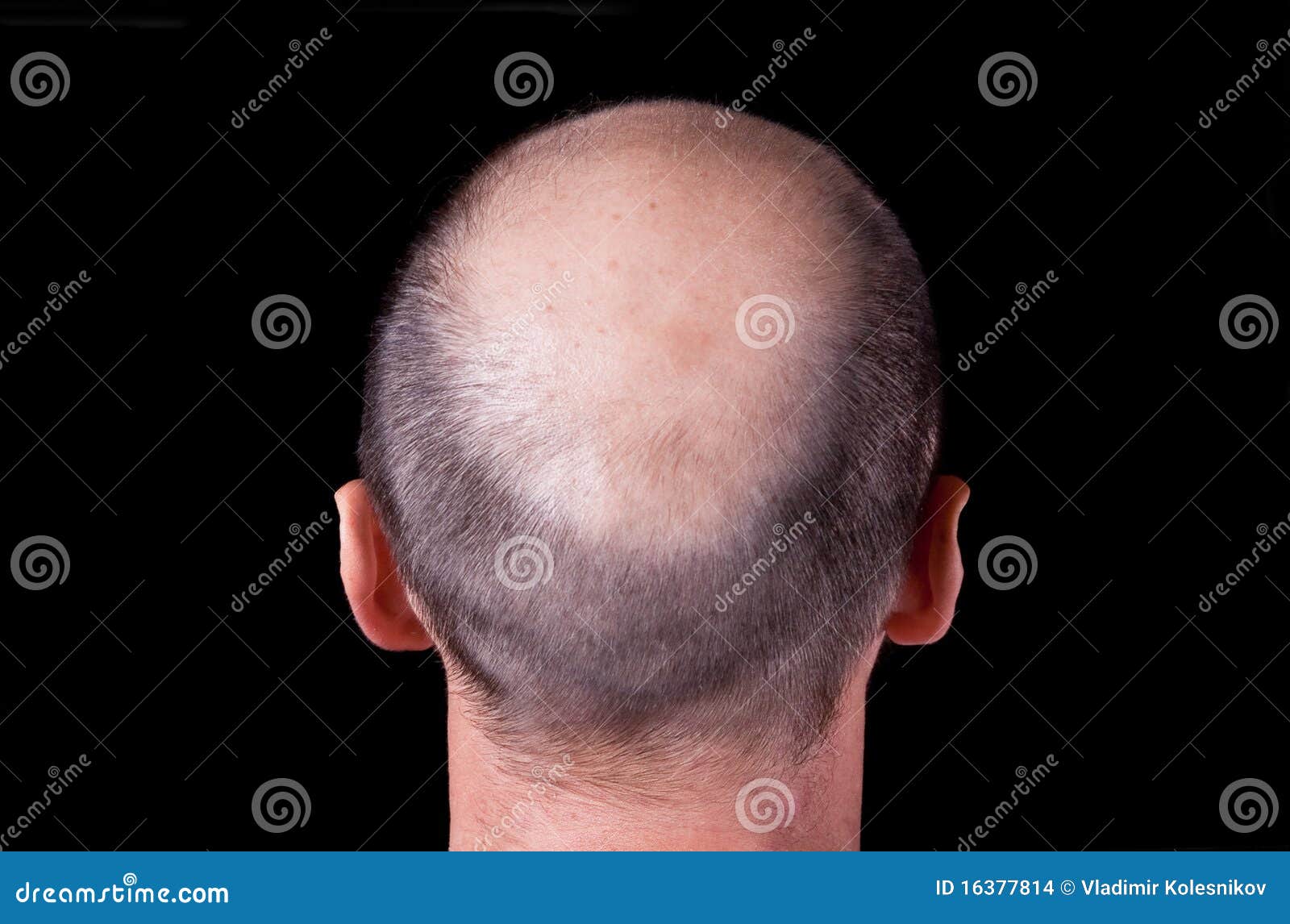 Bald man s head stock photo. Image of white, people, skin - 16377814
