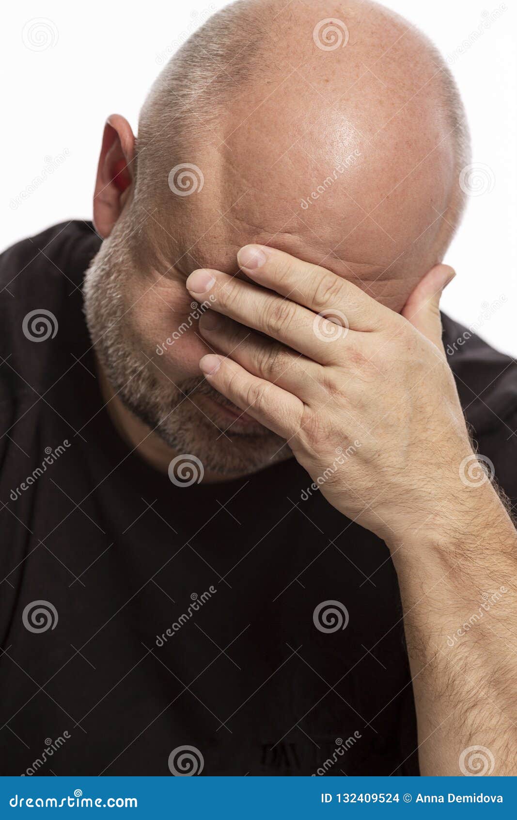 A Bald Man Thinks Covered His Face with His Hands Stock Photo - Image ...