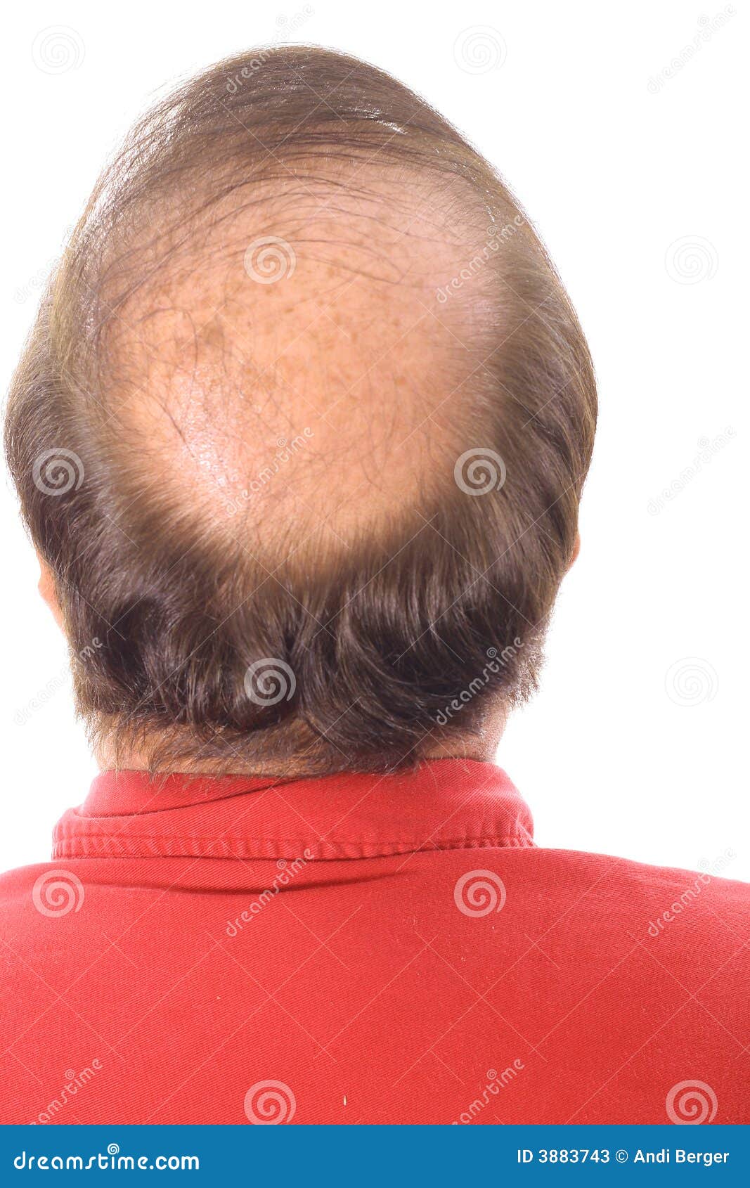 Balding man stock image. Image of adult, hair, grand, growth - 3883743