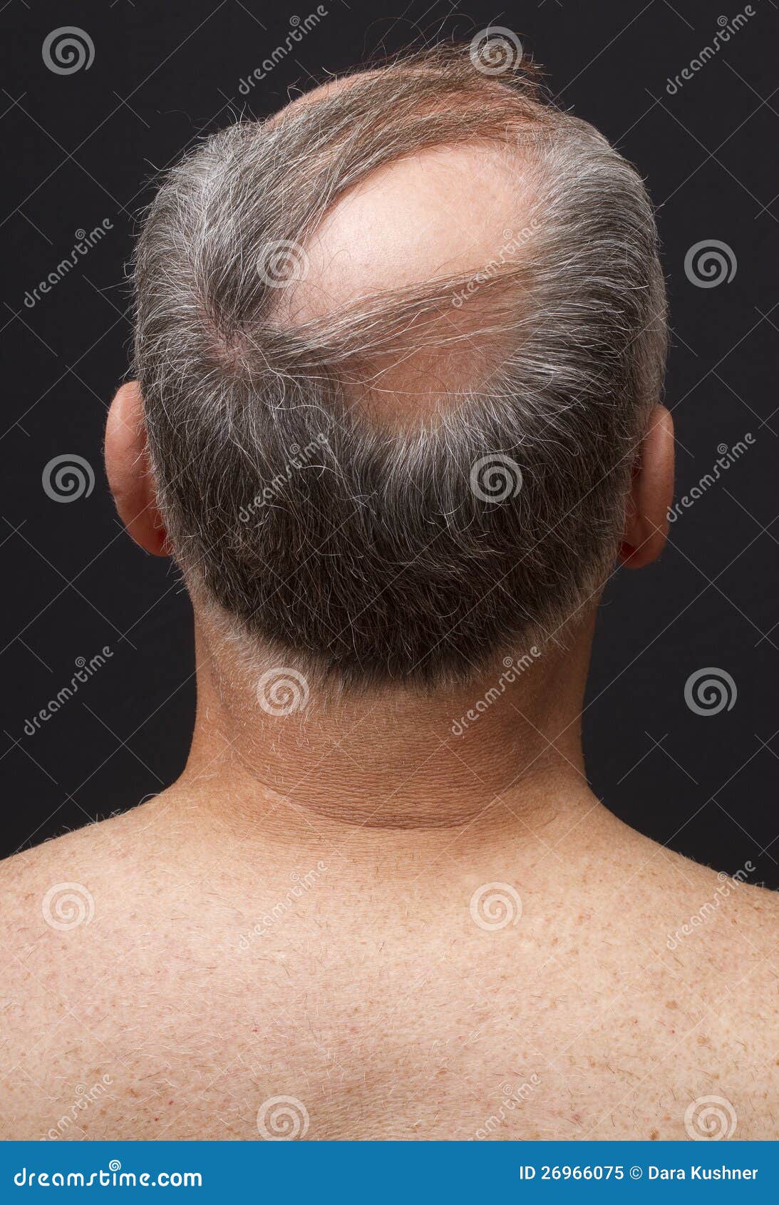 Balding Man s Head stock image. Image of male, care, concepts - 26966075