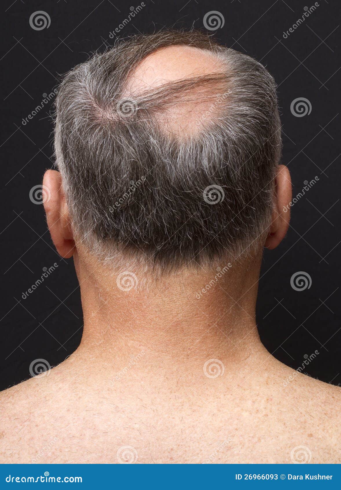 Balding Man S Head Portrait Stock Image - Image of caucasian, concepts ...