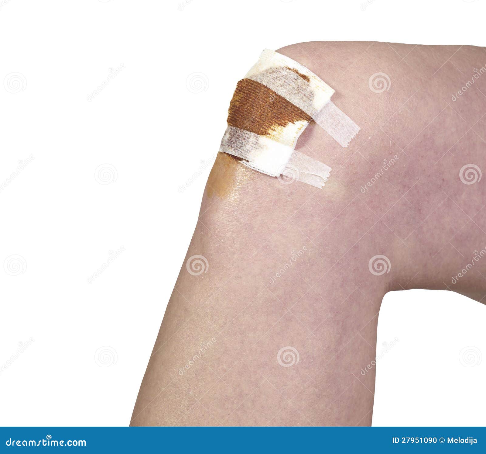 Band-aid on knee. stock photo. Image of wound, adhesive - 27951090