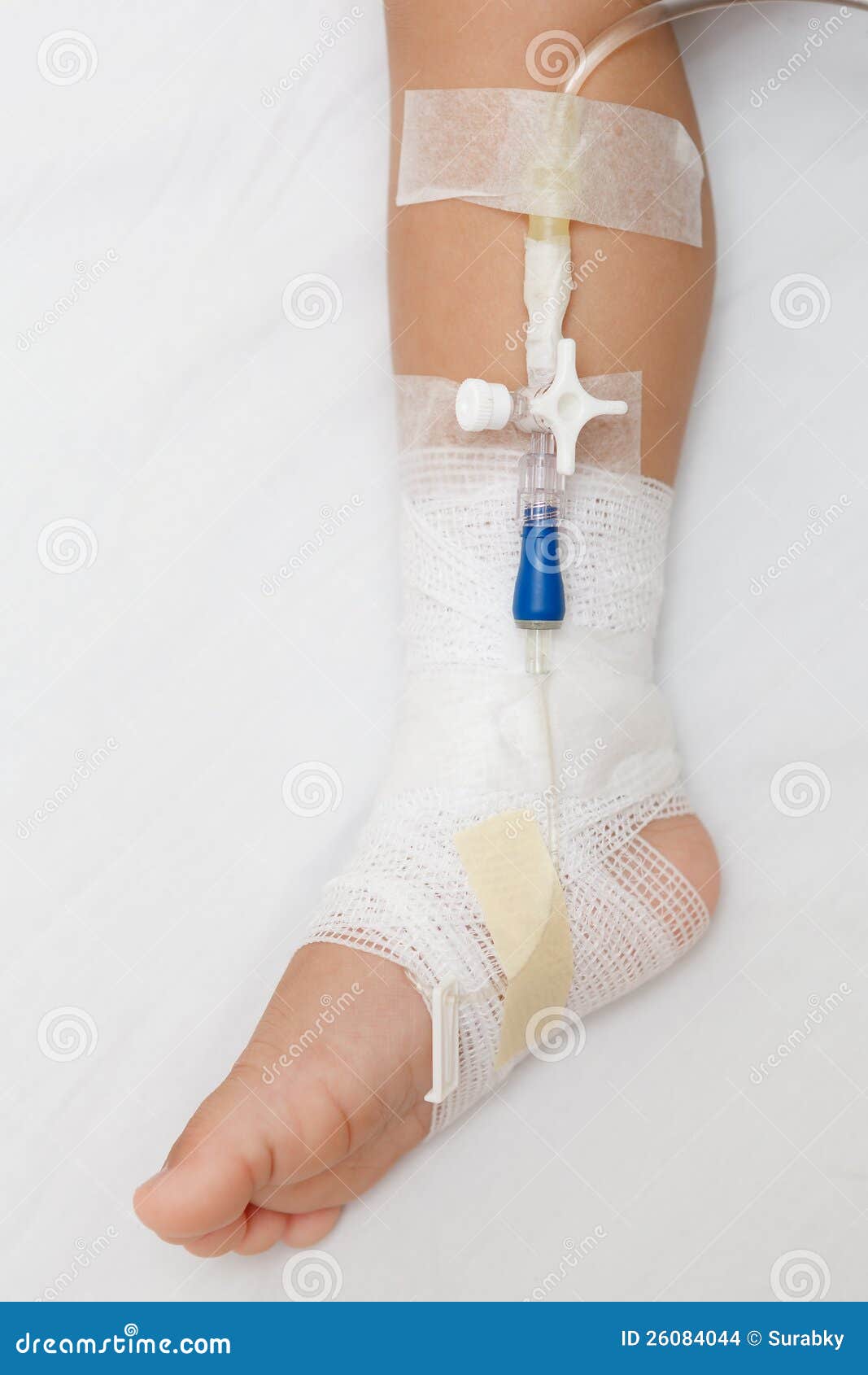 Bandage on baby leg stock photo. Image of health, foot - 26084044
