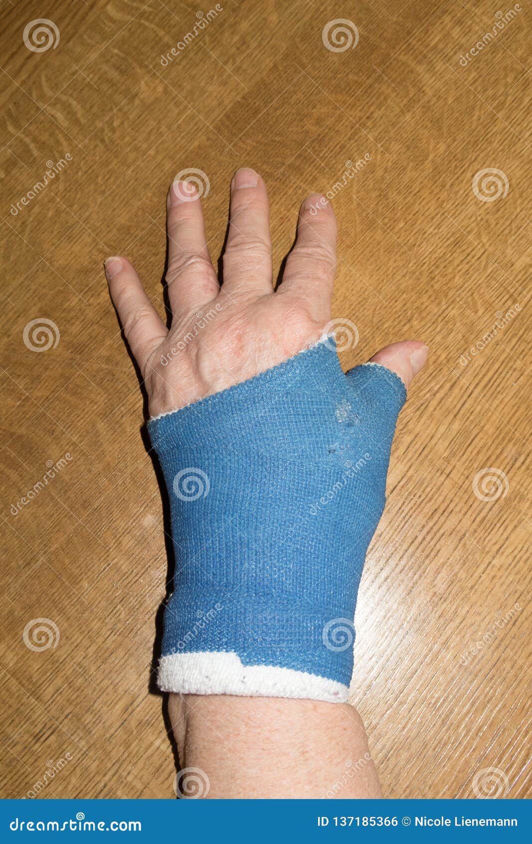 Bandage hand stock photo. Image of human, woman, orthopedic - 137185366