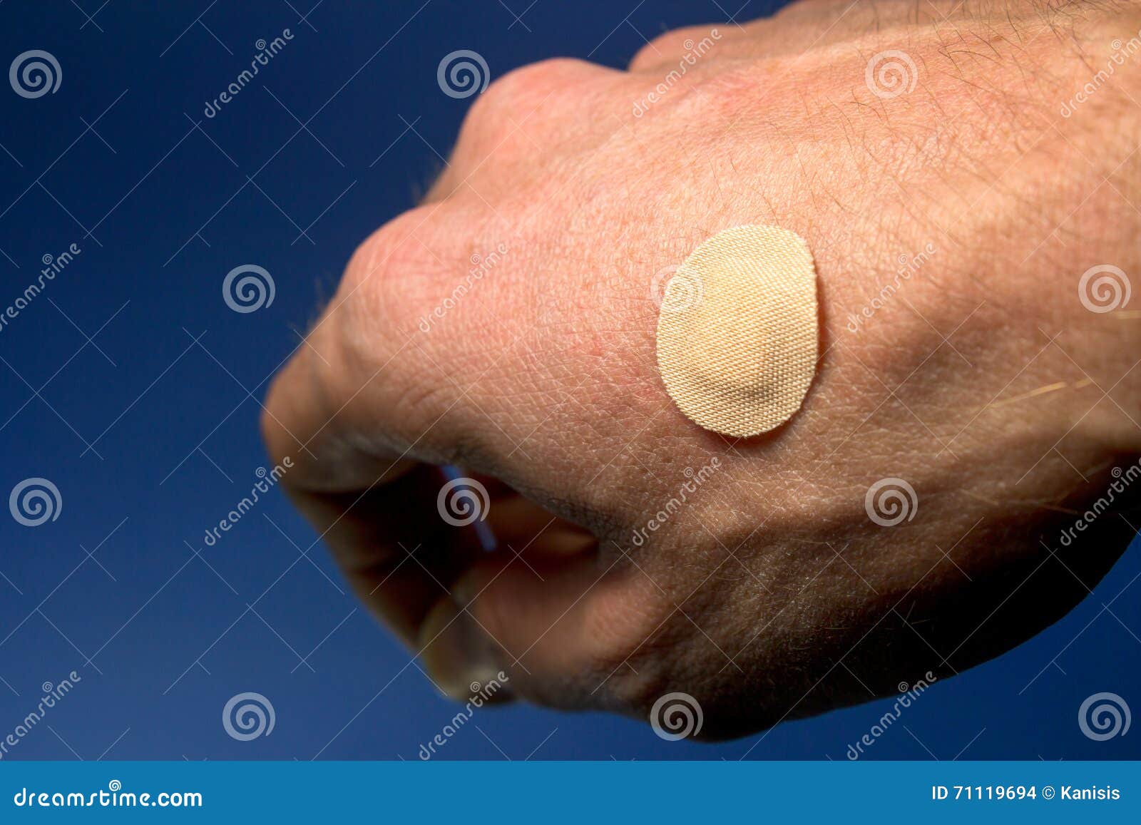 Bandage on a Hand Wound As a First Aid Stock Photo - Image of hospital ...