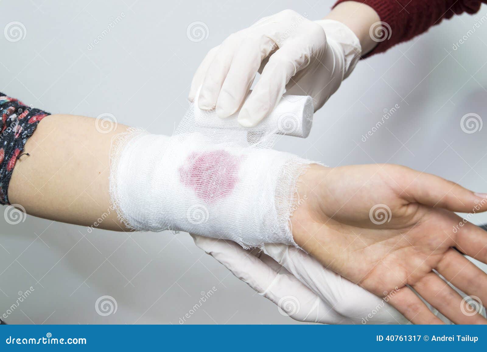 Bandage techniques stock image. Image of medical, health - 40761317