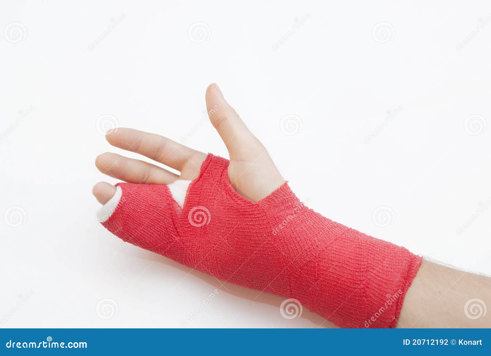 Bandaged Arm with Broken Finger Stock Photo - Image of care, medical ...