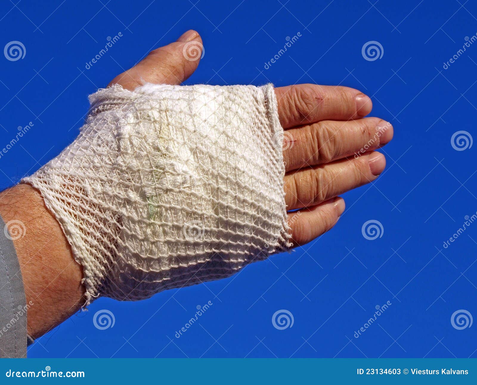 Bandaged hand stock image. Image of health, support, white - 23134603
