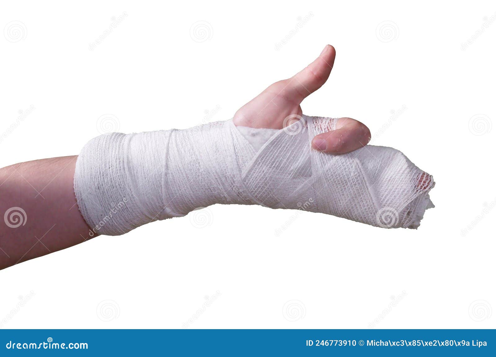 Bandaged Hand Showing Thumb Up. Hand Injury Stock Photo - Image of ...