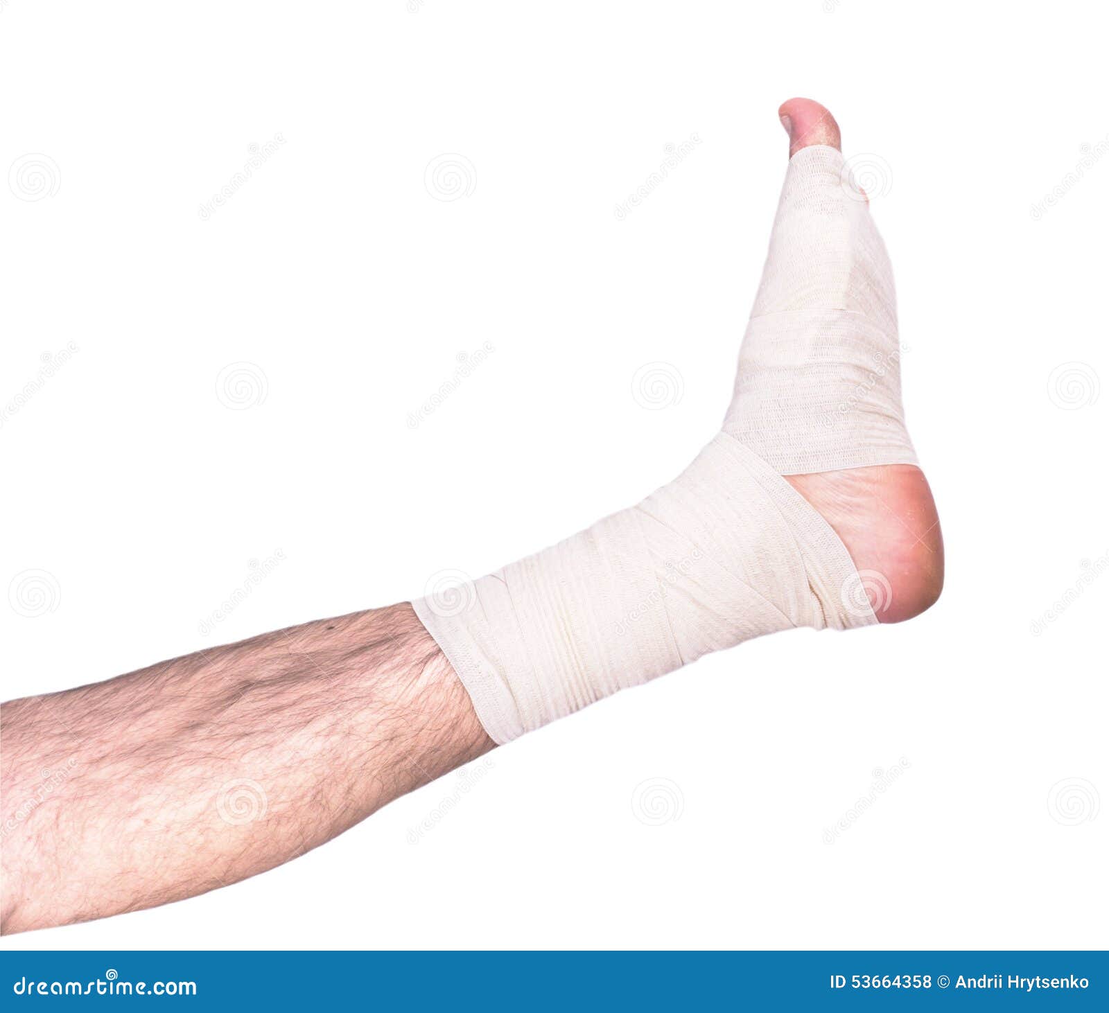 Bandaged leg damaged stock photo. Image of barefoot, human - 53664358